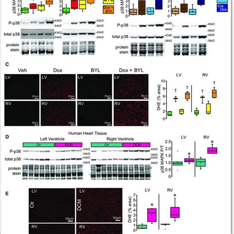 Revised Task Force Criteria For Electrocardiographic Diagnosis Of Arvc
