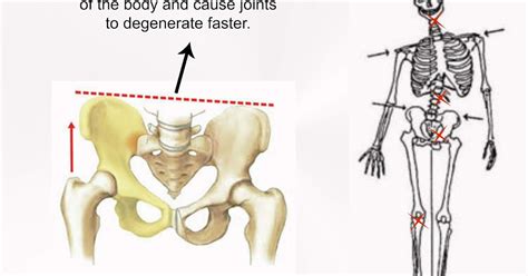 Singapore Hijama Bekam Bone Alignment Therapy Gurah Resdung Sinusitis Bone Align Nerve