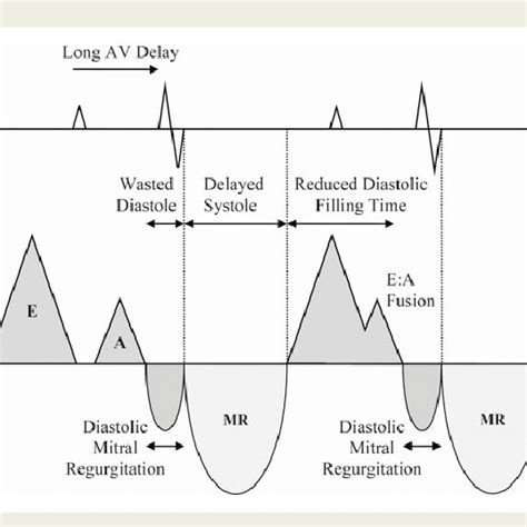 Effect Of Lengthening Atrioventricular Delay Download Scientific Diagram