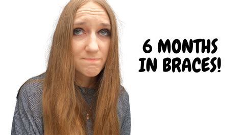 Adult Braces Experience YouTube