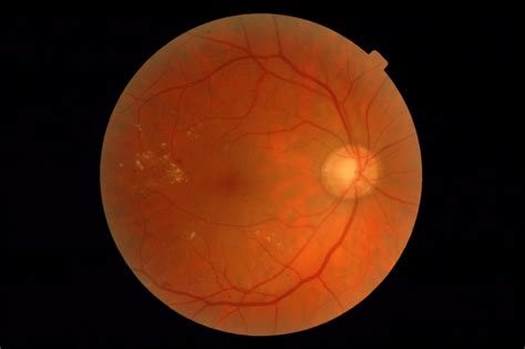 How Can I Segment Entire Objects From Original Image Given A Segmented