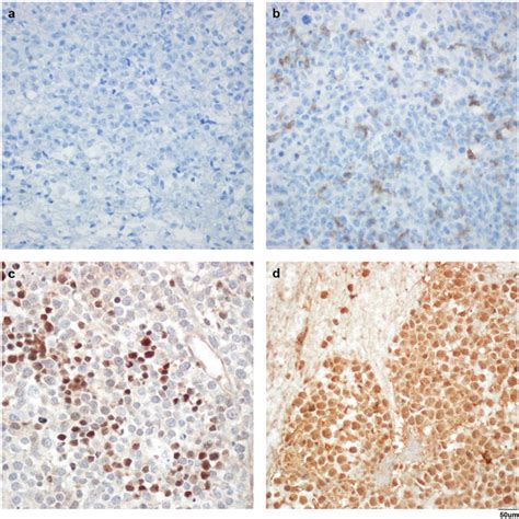 Representative Immunohistochemical Stains In Formalin Fixed And Download Scientific Diagram