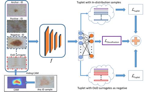 The Flow Diagram Of The Proposed Ood Detection Approach For Skin Cancer Download Scientific