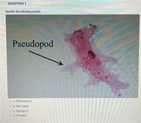 Solved Identify The Following Protist Pseuaopoa A
