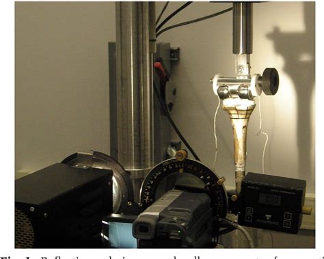 Figure 1 From A Comparison In Proximal Tibial Strain Between Metal Backed And All Polyethylene