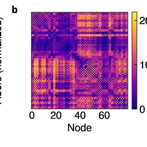 Structural Brain Data A Structural Connectivity Matrix That Defines