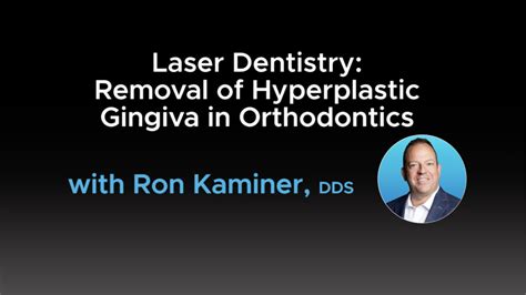 Laser Dentistry Removal Of Hyperplastic Gingiva In Orthodontics