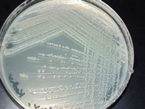 Plate Of Enterobacter Aerogenes Thats Been Streaked For Isolation Notice The Individual