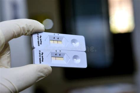 A Positive And A Negative Result Of Sars Cov 2 Rapid Antigen Ag Test