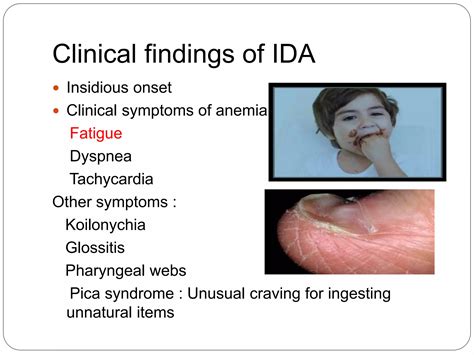 Microcytic Hypochromic Anemia Pptx