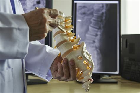 내시경 이용한 척추질환 치료 허리 나사못 재수술도 척척