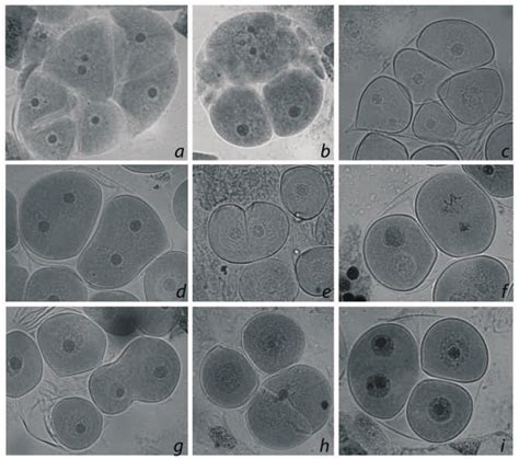 Rregularities On The Stage Of Tetrad Of Microspores In Larix Gmelini At Download Scientific