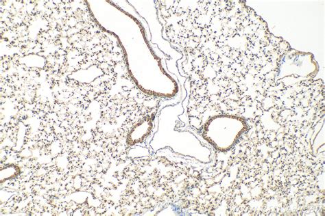 Tac4 Antibody 21232 1 Ap Proteintech