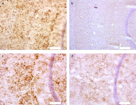 Anti Ttg Antibody Specificity In Sagittal Whole Brain Sections Of App23 Download Scientific