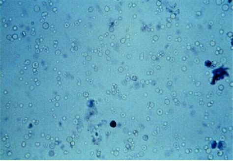 EL RINCÓN DE LA MEDICINA INTERNA juanpedromacaluso yahoo com ar 22 jul 2012