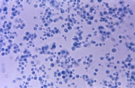 Cryptococcus Neoformans Var Gattii Filobasidiella Bacillispora Hongo Agentes Biológicos