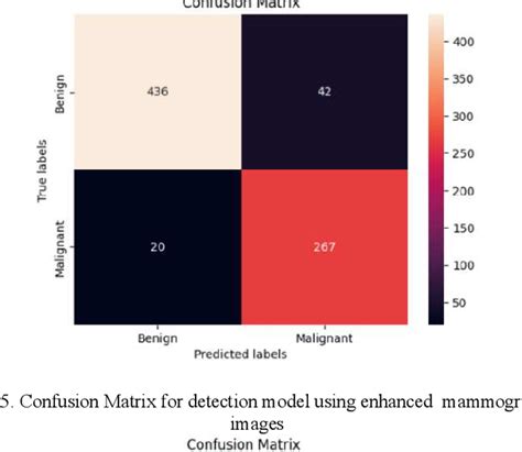 Figure 5 From Improved Breast Cancer Detection Using Wavelet Based Image Enhancement Semantic