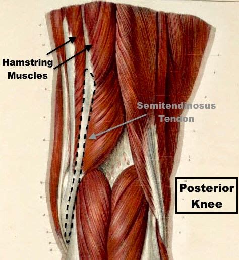 Essentials Of Choosing An Acl Graft