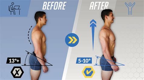 The Perfect 10 Minute Daily Posture Routine Fix Your Sit Youtube