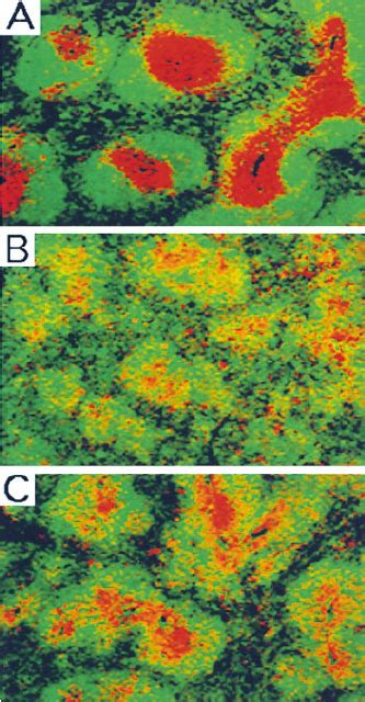 Immunofluorescent B And T Cell Staining Of The Spleen Spleen Sections
