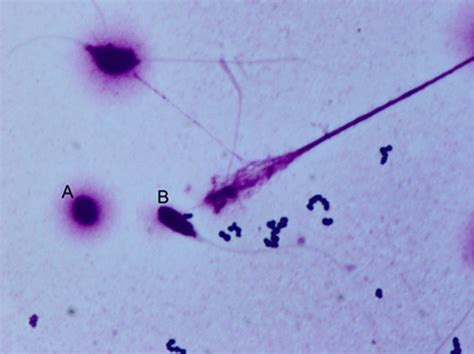 Sperm Chromatin Dispersion Scd Test A Sperm With A Large Sized Halo Download Scientific
