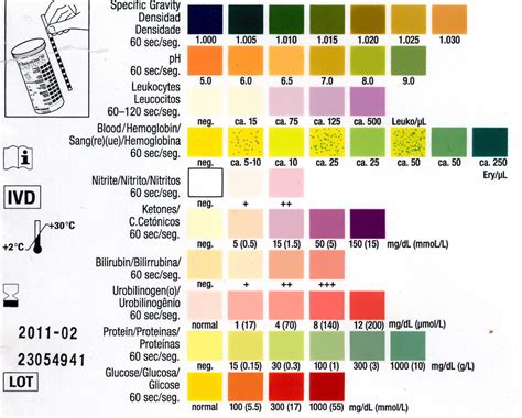 Urine Specific Gravity Lab Tests Guide