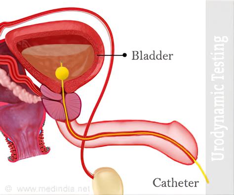 Urodynamic Testing Procedure