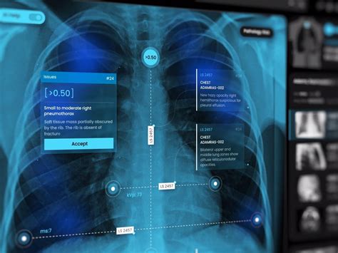 Pin By Omario Satter On Data Visualizations Hospital Design System