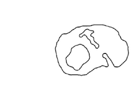 The Segmentation Results Of The Ct Image A And D Results Using Cv