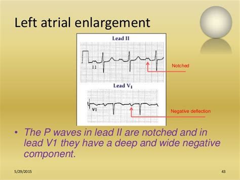 Role Of Ecg In Pulmonology