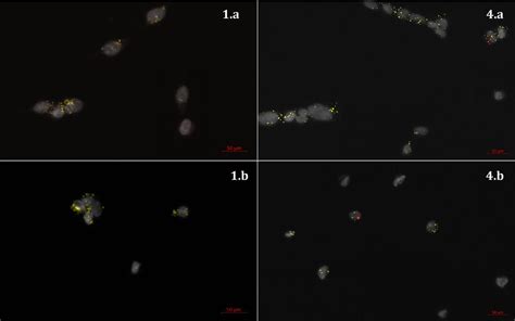 Figure 1 From Optimization Of A Mrna Based In Situ Padlock Probe Approach Semantic Scholar