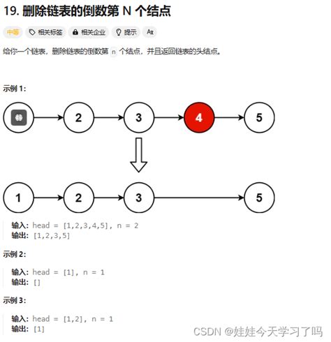 Leetcode 做题记录 19 删除链表的倒数第n个节点 Csdn博客