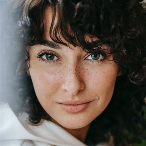 The Skinfirm PMU Sproetjes