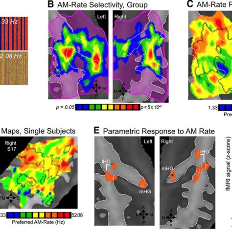 Topographic Organization By Preferences For Temporal Modulation Rate In Download Scientific