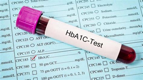 How Is The A C Test Done Diabetes Self Management