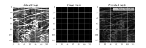 GitHub ShrutiRajput Ultrasound Nerve Segmentation The Project Is Based On CNN U Net We