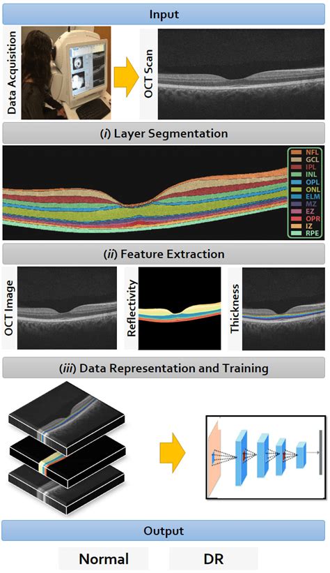 Proposed Cad System For Dr Diagnostic Using Oct Download Scientific Diagram
