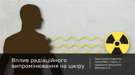 Вплив радіації на шкіру Презентации Радиология Docsity
