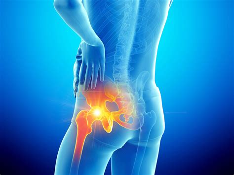 What Are The Risks Of Hip Replacement Surgery