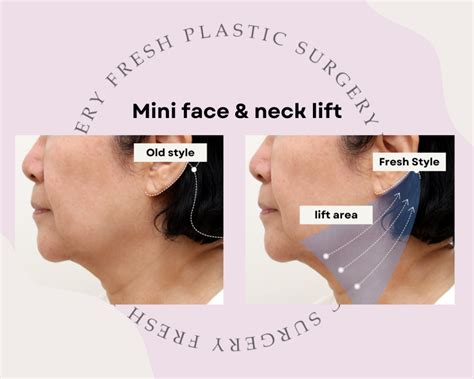 Simplebut Effective Rejuvenation The Mini Face Lift Makeover Fresh