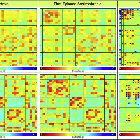 Resting State Fmri And Meg Functional Connectivity Functional Download Scientific Diagram