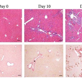 Dynamic Expression Of CCN Proteins In HPC And Human CCA Tumors A Download Scientific Diagram