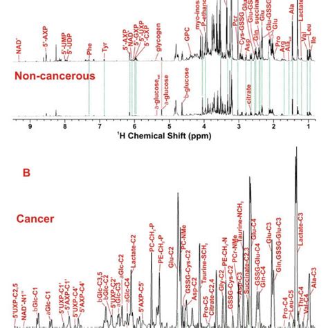 1h 13c 2 D Hsqc Identification Of 13c Metabolites In The Tca Extracts Download Scientific