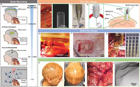 Type Of Neural Interfacing Electordes For Monitoring Brain Download Scientific Diagram