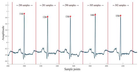 Combining The Taguchi Method And Convolutional Neural Networks For