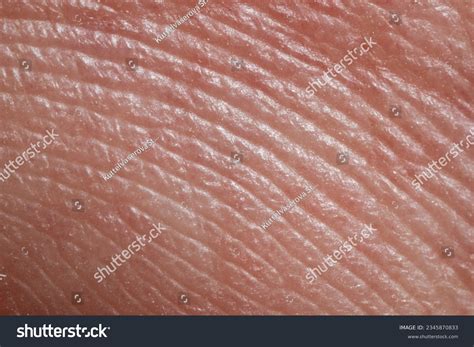 Human Epidermis Microscope