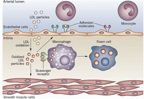 Anti Atherogenic Actions Of Thymoquinone 5518 Words Research Paper