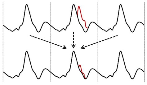 Principle Of Ea Algorithm Black Is The Bioimpedance Signal Dz Dt Red Download Scientific