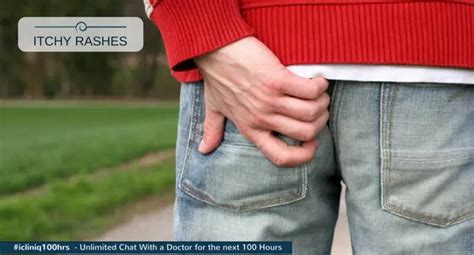 What Is The Treatment For Itchy Rashes Around Anus