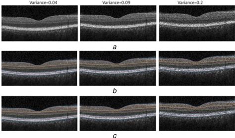Segmentation Results A Synthetic Images B Synthetic Boundaries Download Scientific